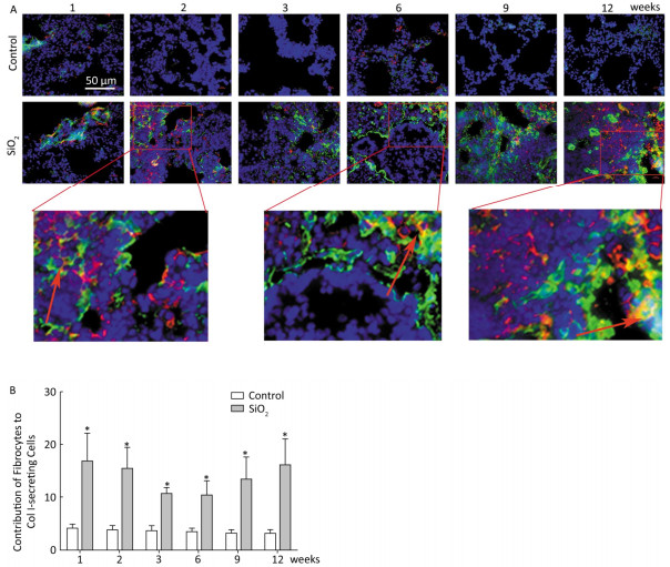 The Role of Fibrocyte in the Pathogenesis of Silicosis