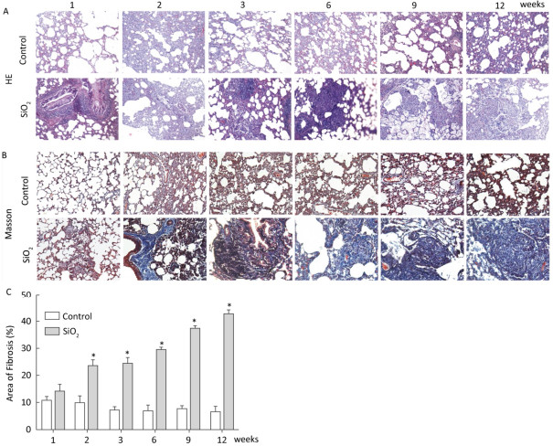 The Role of Fibrocyte in the Pathogenesis of Silicosis