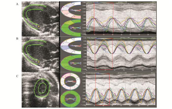斑点追踪成像评价压力负荷型心衰小鼠左室收缩功能的变化