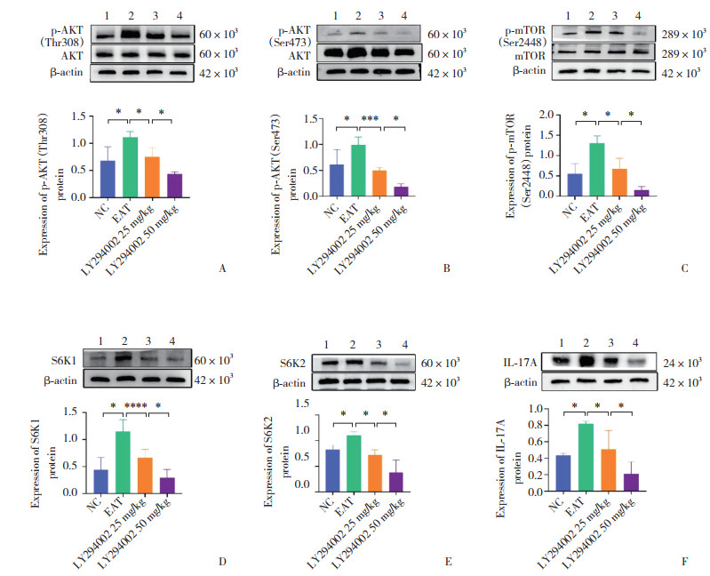 PI3K/AKT/mTOR信号通路通过调控Th17细胞分化参与EAT小鼠甲状腺自身免疫损伤