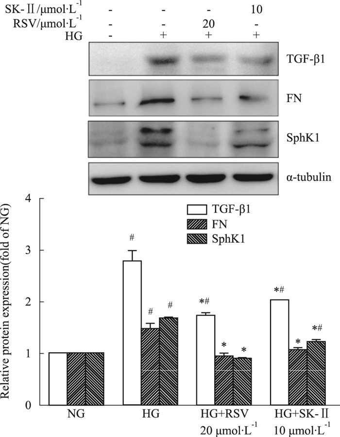 白藜芦醇调节SphK1/AP-1信号通路抑制高糖诱导的肾小球系膜细胞增殖