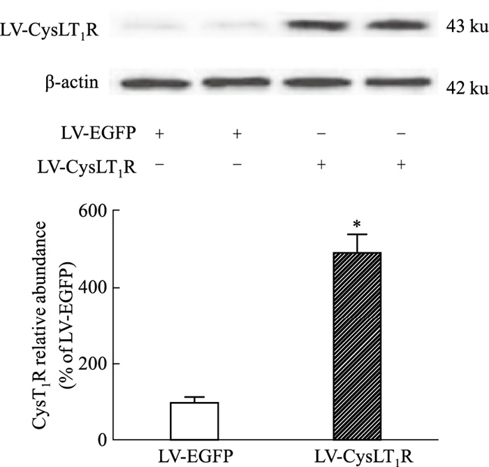 CysLT 1 R对APP-HEK293细胞Aβ生成的调控作用及其机制