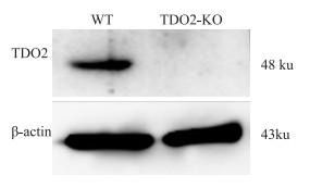 TDO2基因敲除小鼠模型的建立和初步表型研究