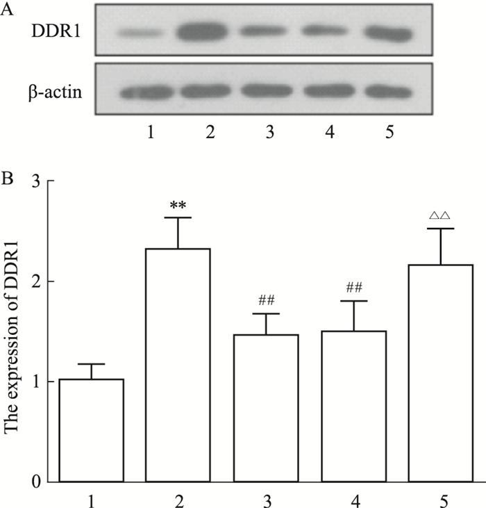 维生素A调控DDR1介导的细胞自噬对孤独症大鼠神经行为学的影响
