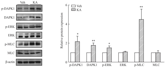 DAPK1调控癫痫发作诱导的阿尔茨海默病样病变