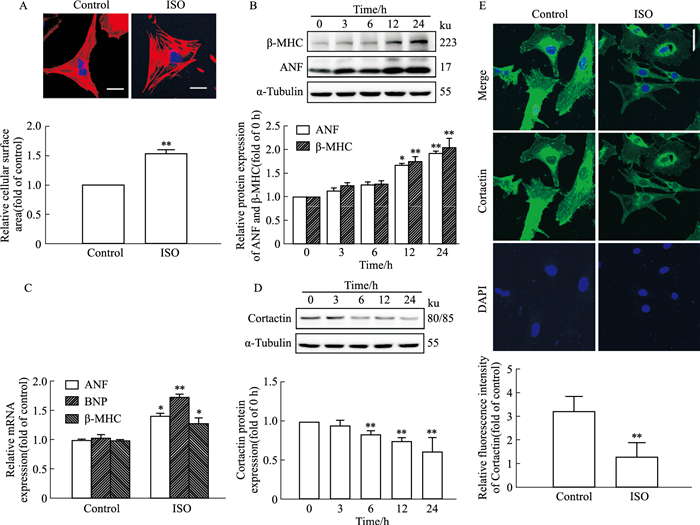 Cortactin/N-cadherin信号轴在病理性心肌肥大中的作用