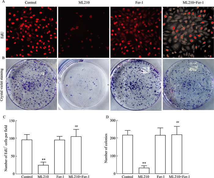 ML210通过调控GPX4介导的铁死亡通路抑制脑胶质瘤细胞的作用