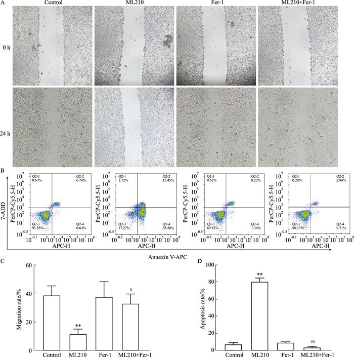 ML210通过调控GPX4介导的铁死亡通路抑制脑胶质瘤细胞的作用