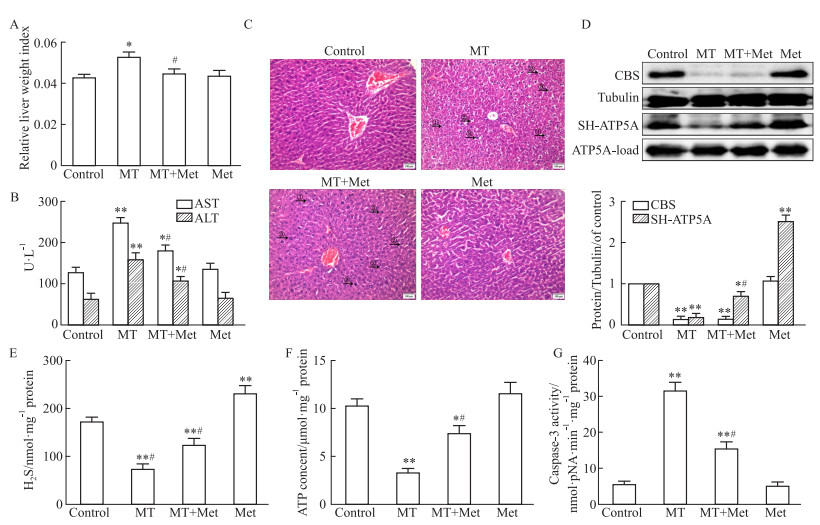 苦参碱通过抑制CBS/H 2 S/ATP5A通路诱导肝毒性