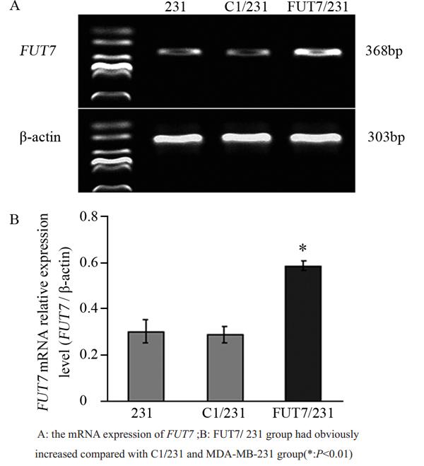 过表达外源 FUT7 对乳腺癌细胞黏附及迁移能力的影响