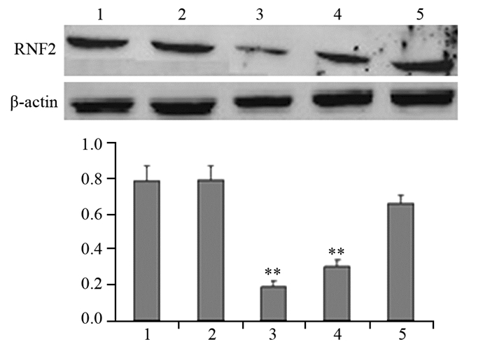 靶向沉默RNF2基因对食管癌细胞放射敏感度的影响
