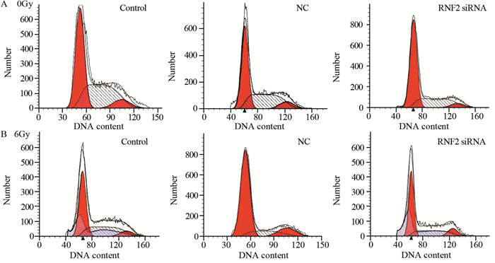 靶向沉默RNF2基因对食管癌细胞放射敏感度的影响