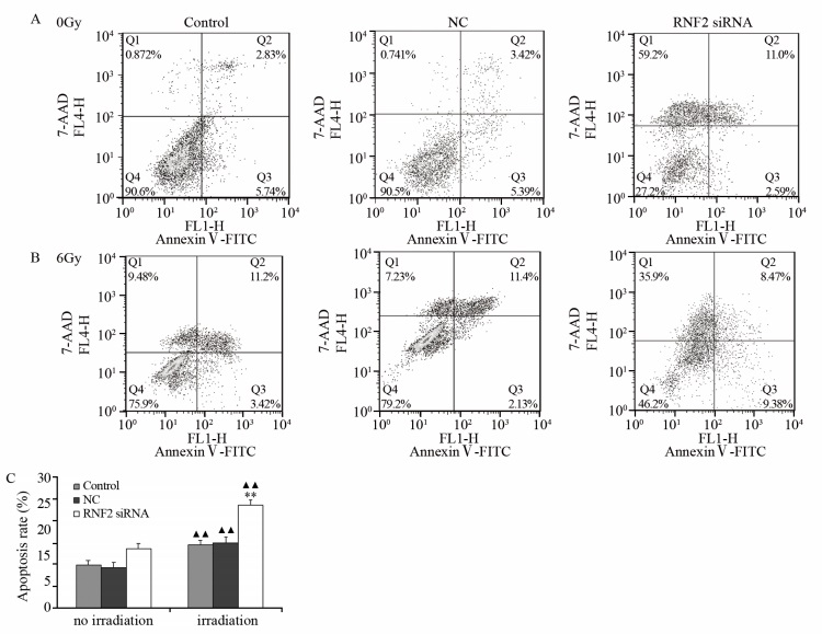 靶向沉默RNF2基因对食管癌细胞放射敏感度的影响