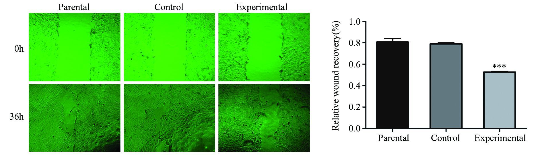 跨膜接头蛋白PAG1过表达对皮肤鳞癌细胞A431运动能力的影响