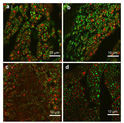 Controlled release of nerve growth factor and basic fibroblast growth ...